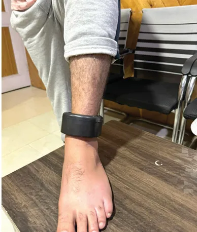 GPS tracker affixed to anklet of 2 terror associates in Sopore ...